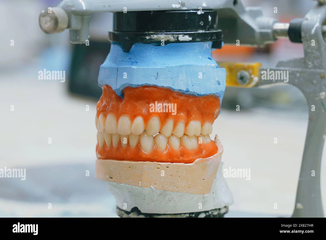 Forming dentures hi-res stock photography and images - Alamy