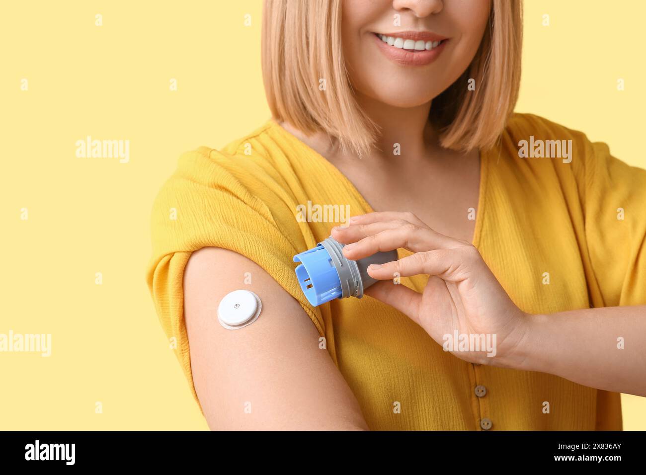 Woman with glucose sensor for measuring blood sugar level and ...