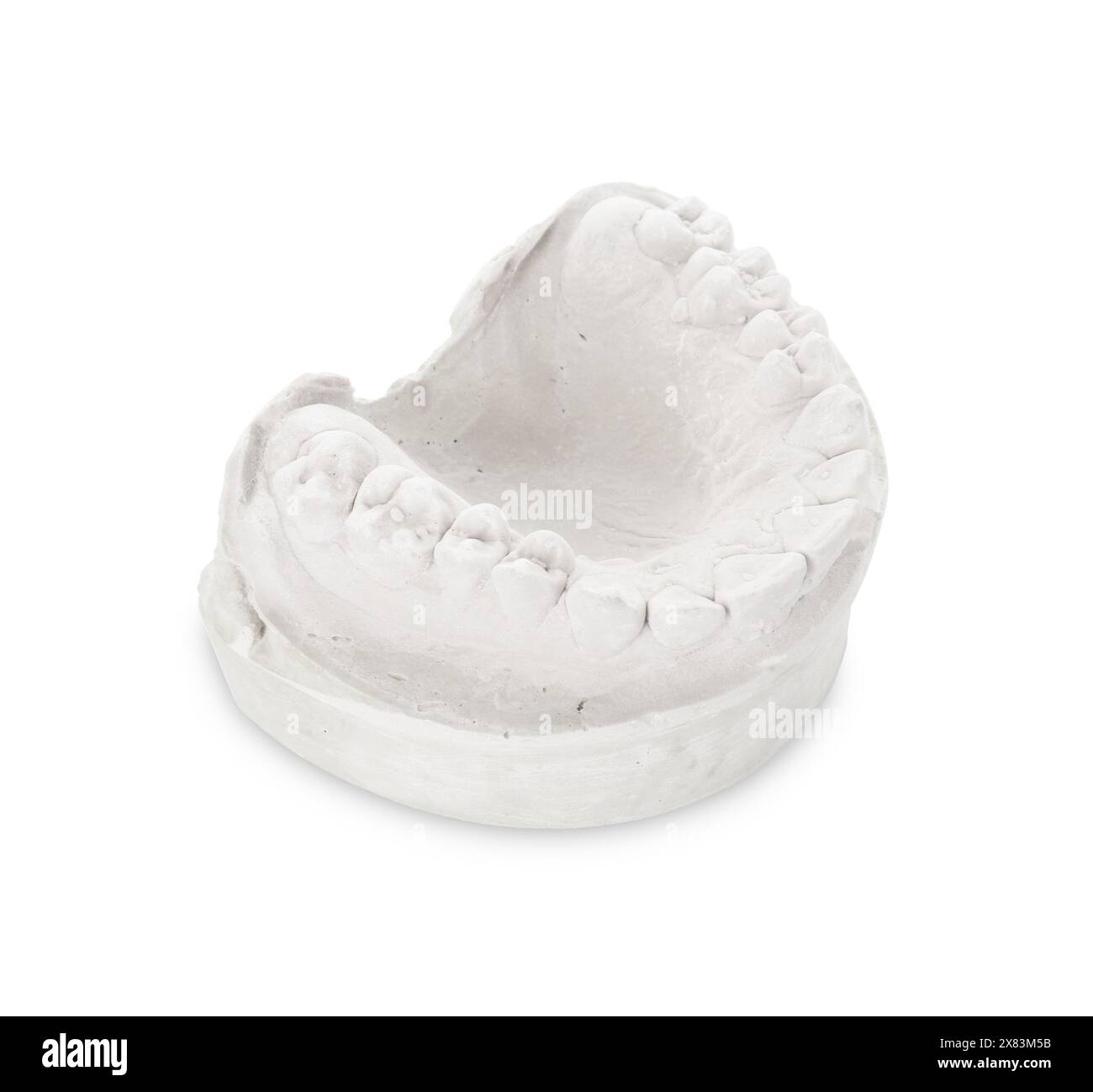 Dental model with jaw isolated on white. Cast of teeth Stock Photo - Alamy