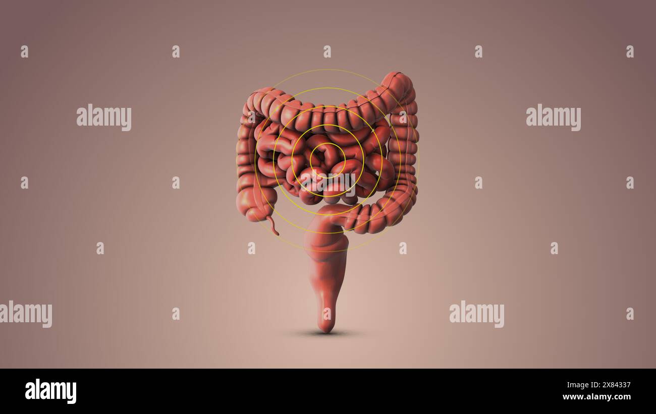 Irritable bowel syndrome hi-res stock photography and images - Alamy