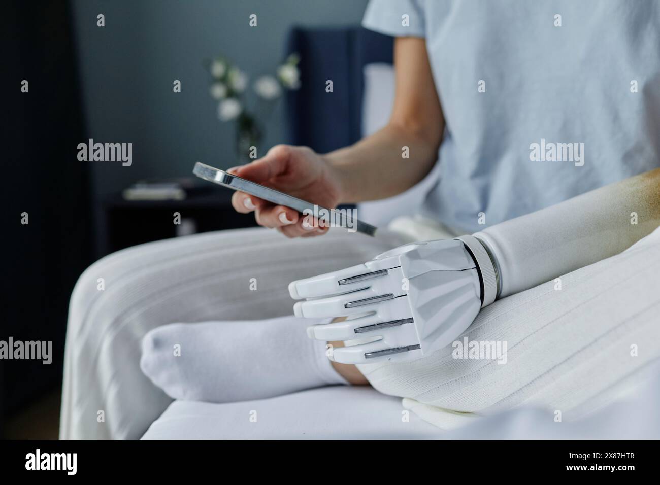 Young woman with bionic arm using mobile phone sitting on bed at home ...