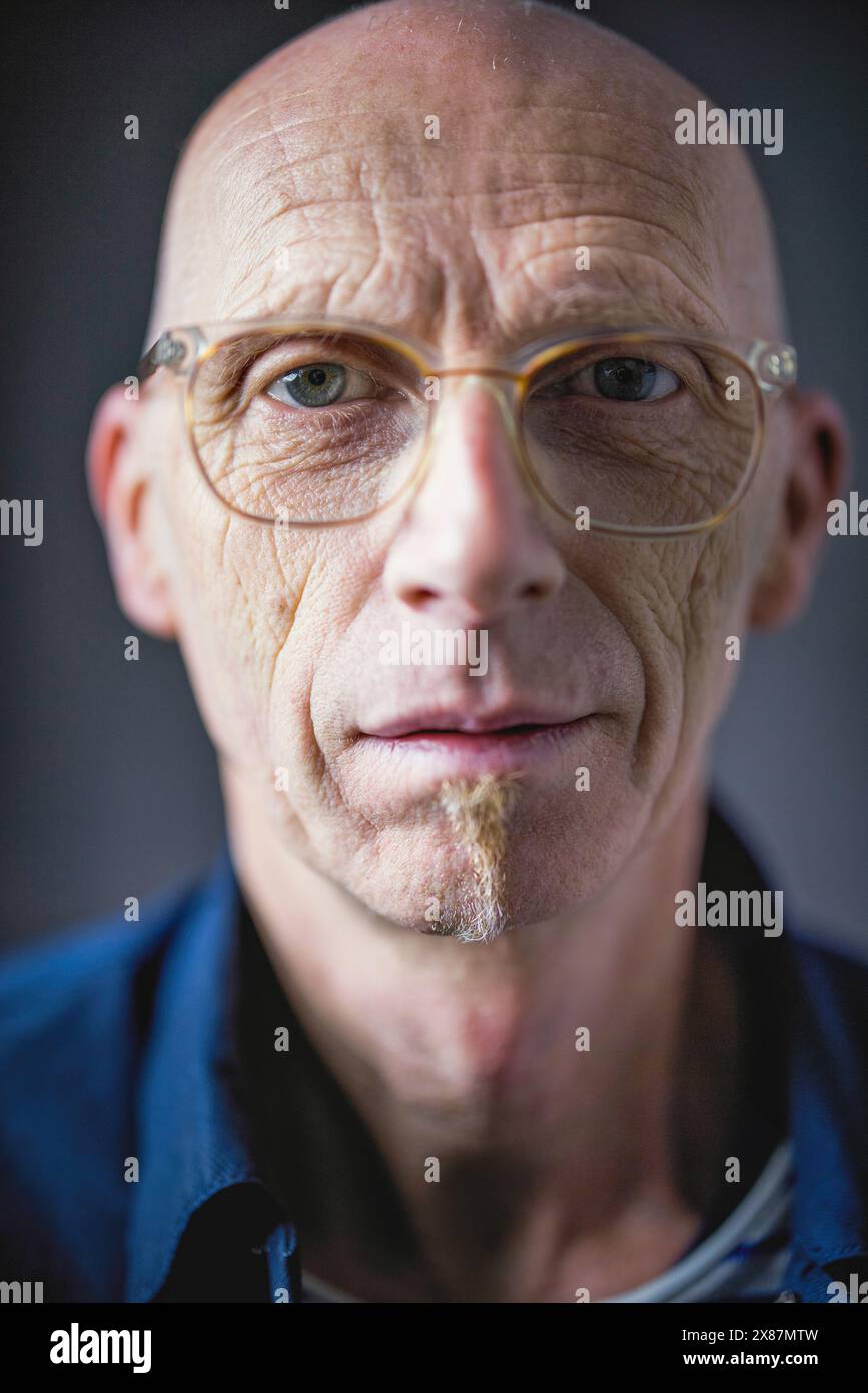 Wrinkled skin hi-res stock photography and images - Alamy