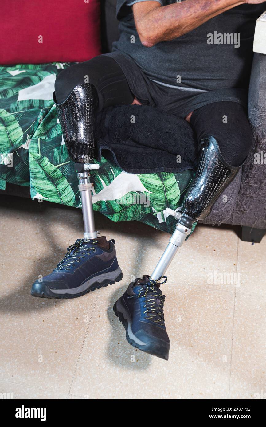 Man with prosthetic legs hi-res stock photography and images - Alamy