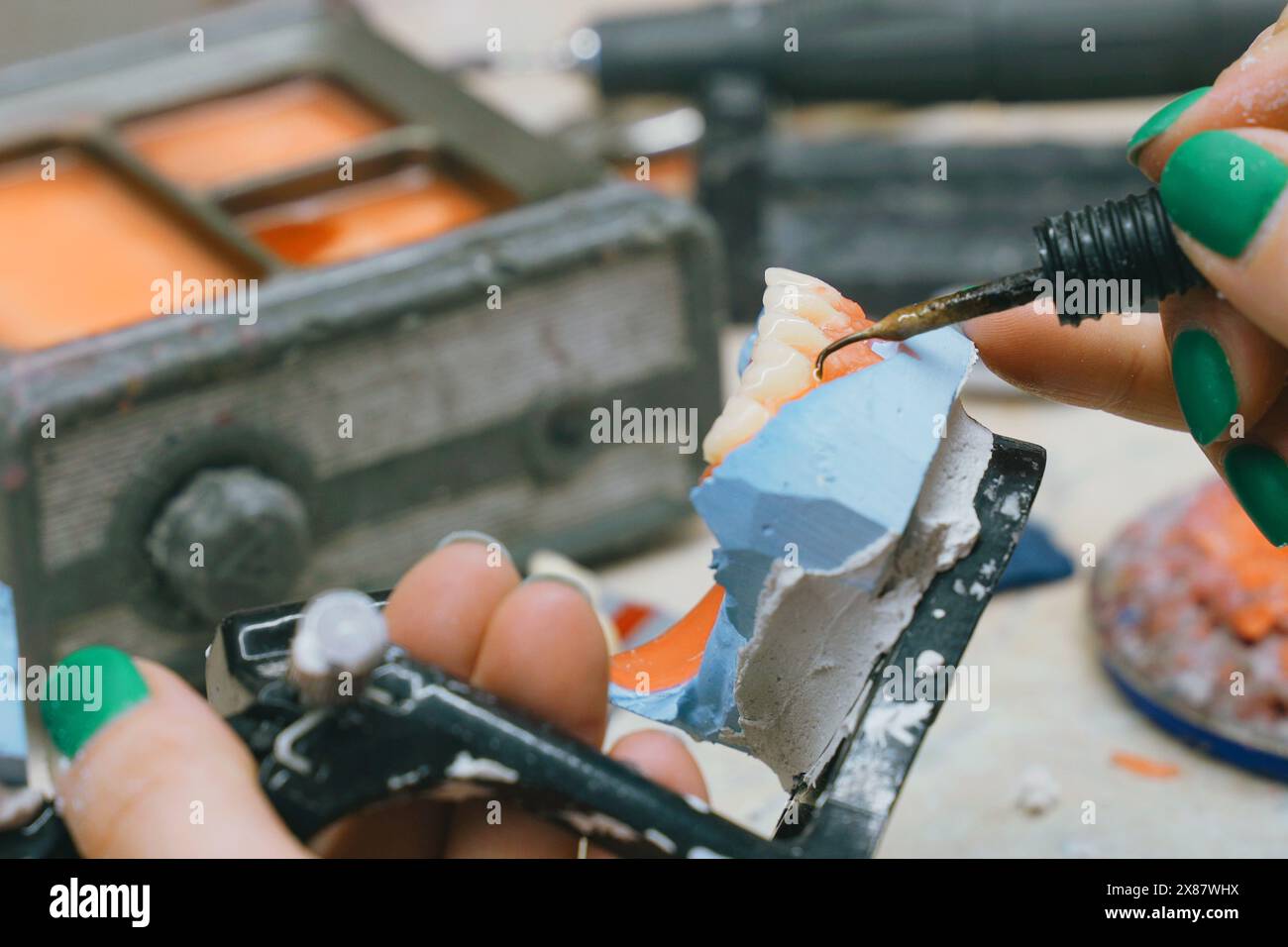 A dental technician is seen soldering, melting, and forming a tooth for ...