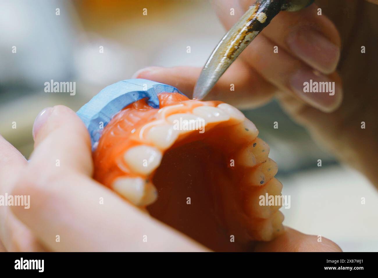 A dental technician uses precision tools to solder and shape dentures ...