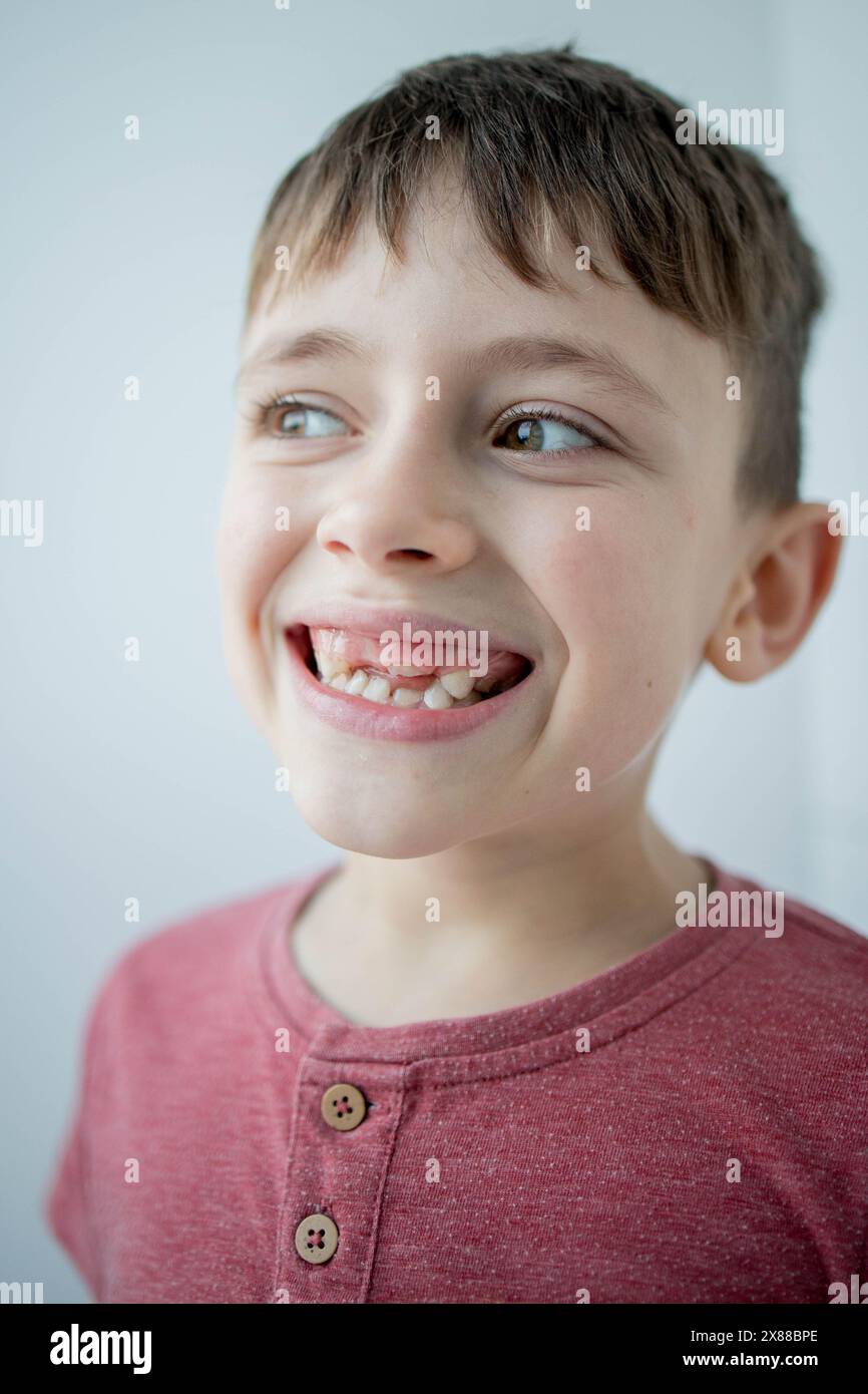 Kid losing a baby tooth and a new permanent tooth coming out Stock ...
