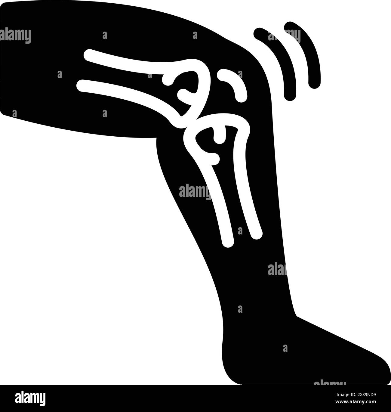 Tendon Stock Vector Images - Alamy