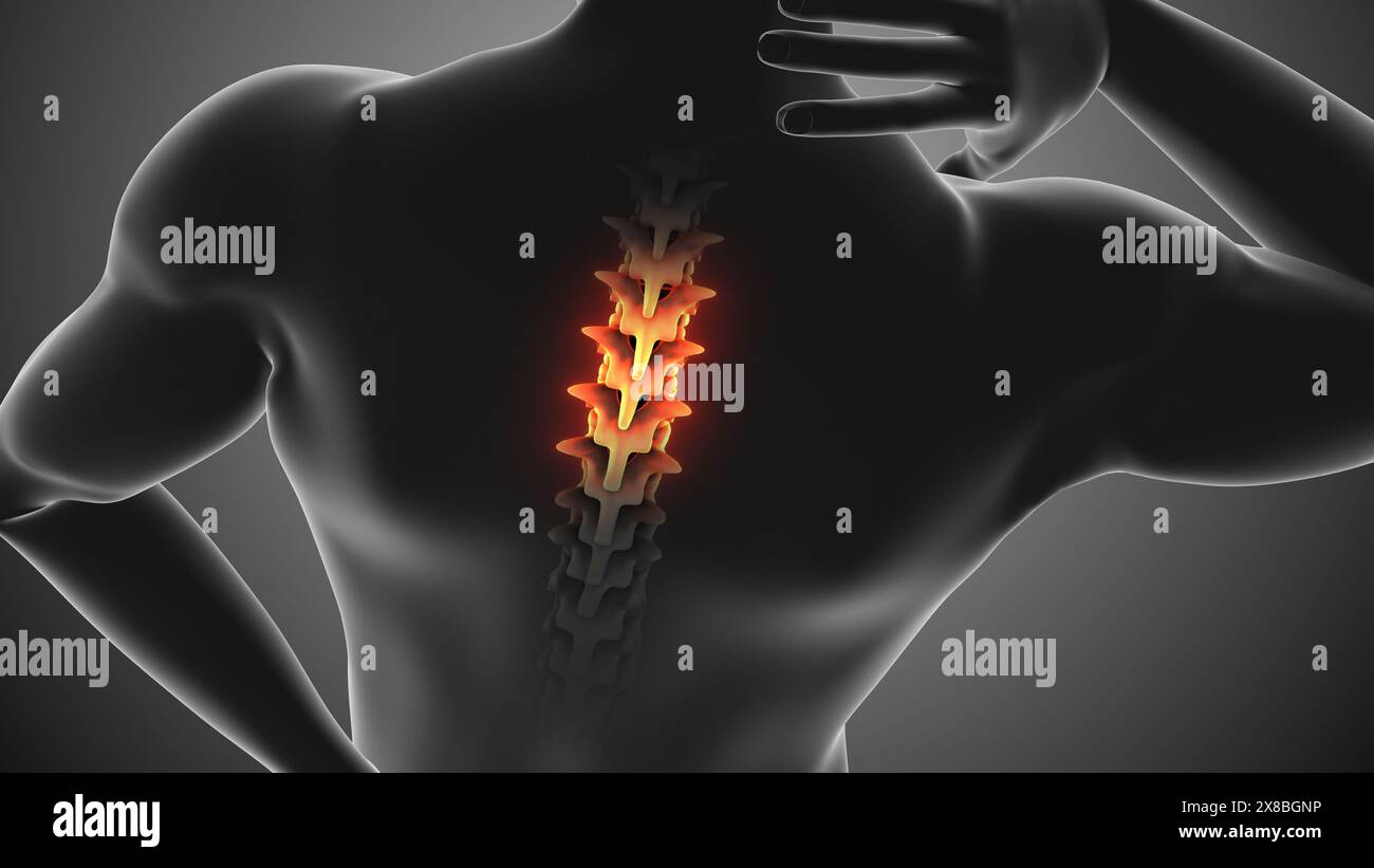 Human body pain anatomy hi-res stock photography and images - Alamy
