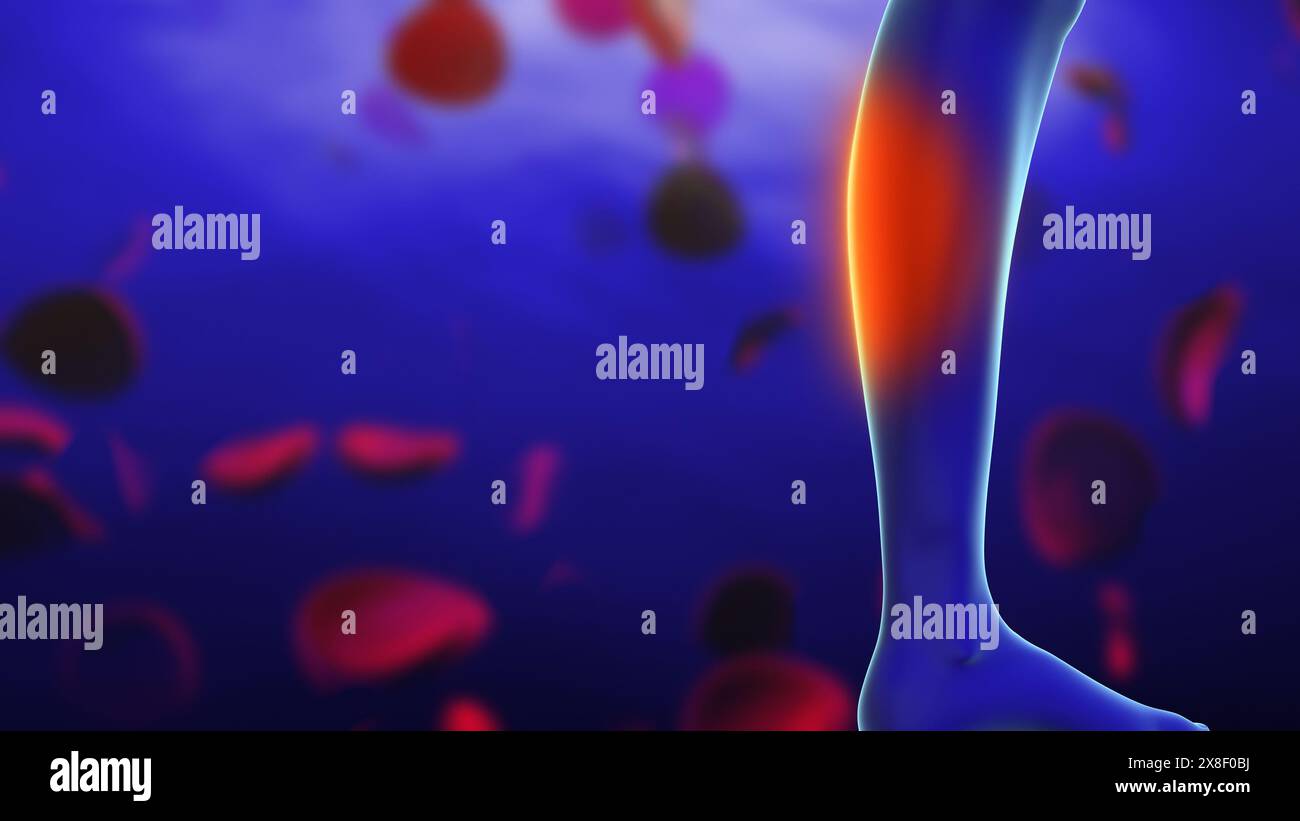 Blood cot hi-res stock photography and images - Alamy