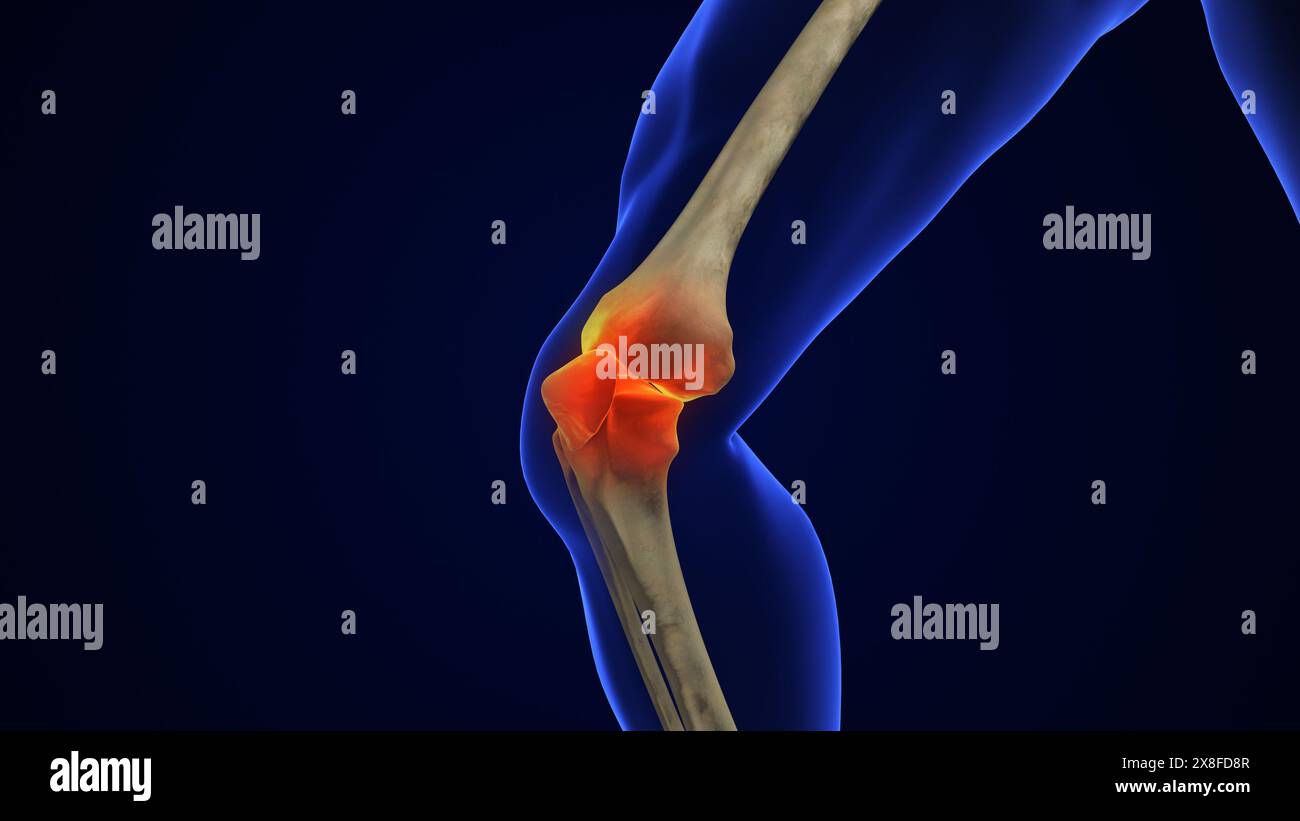 Anatomy Human Knee Joint Treatment, Osteoarthritis Injection Stock ...