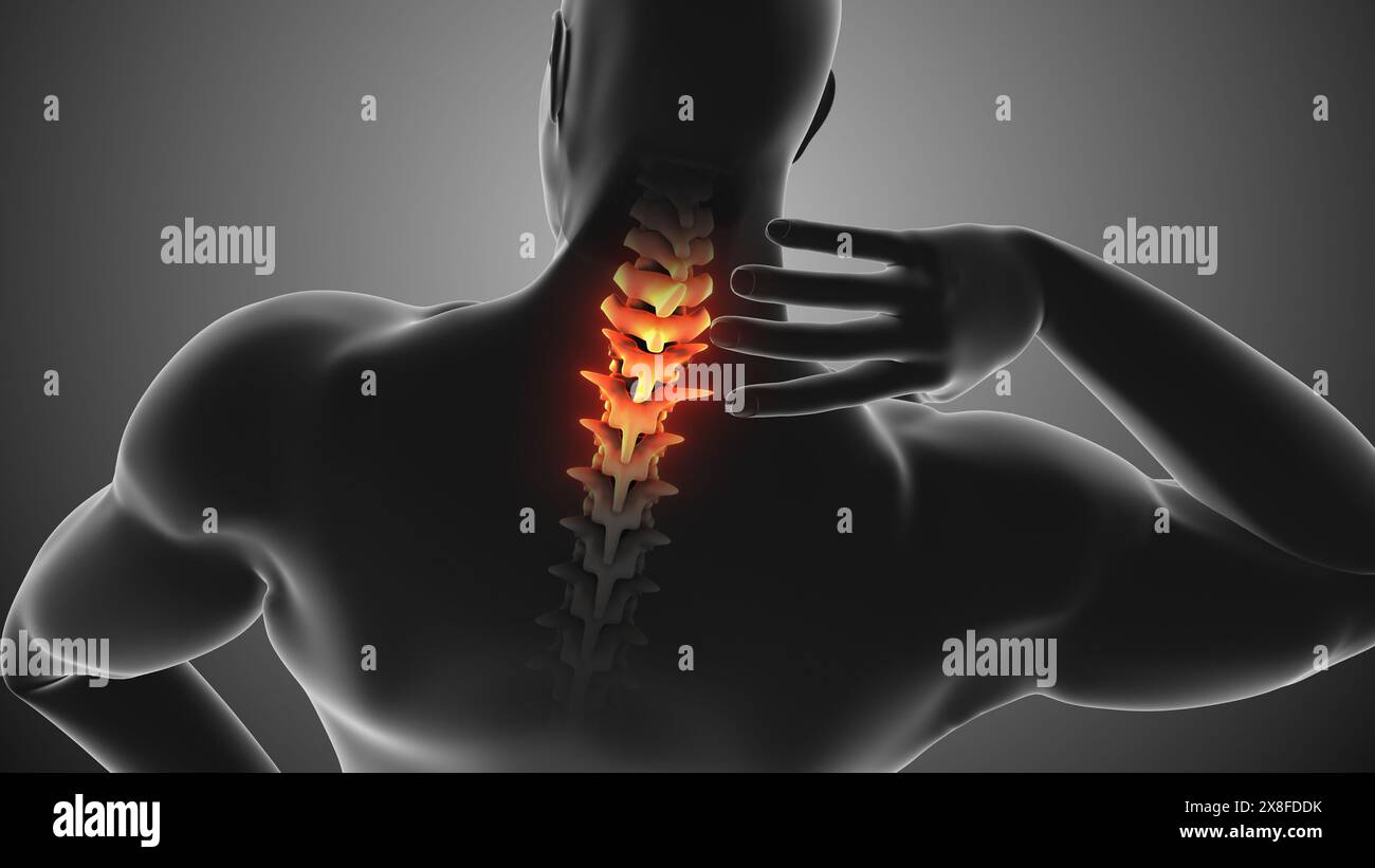 Human body showing spinal pain against a Gray background Stock Photo ...