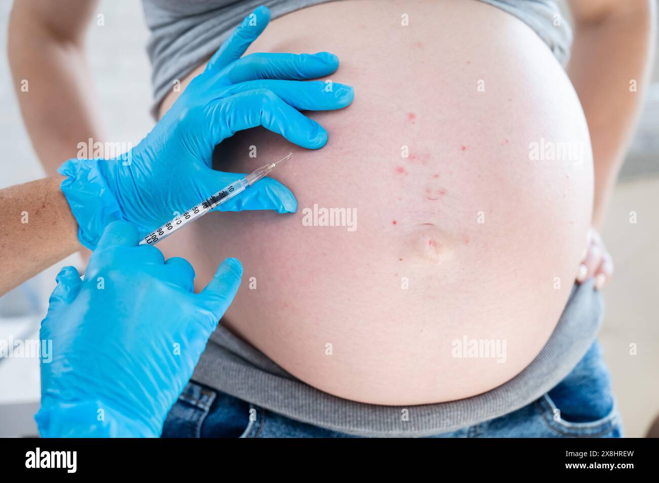 Doctor gives an injection in the stomach of a pregnant woman Stock ...