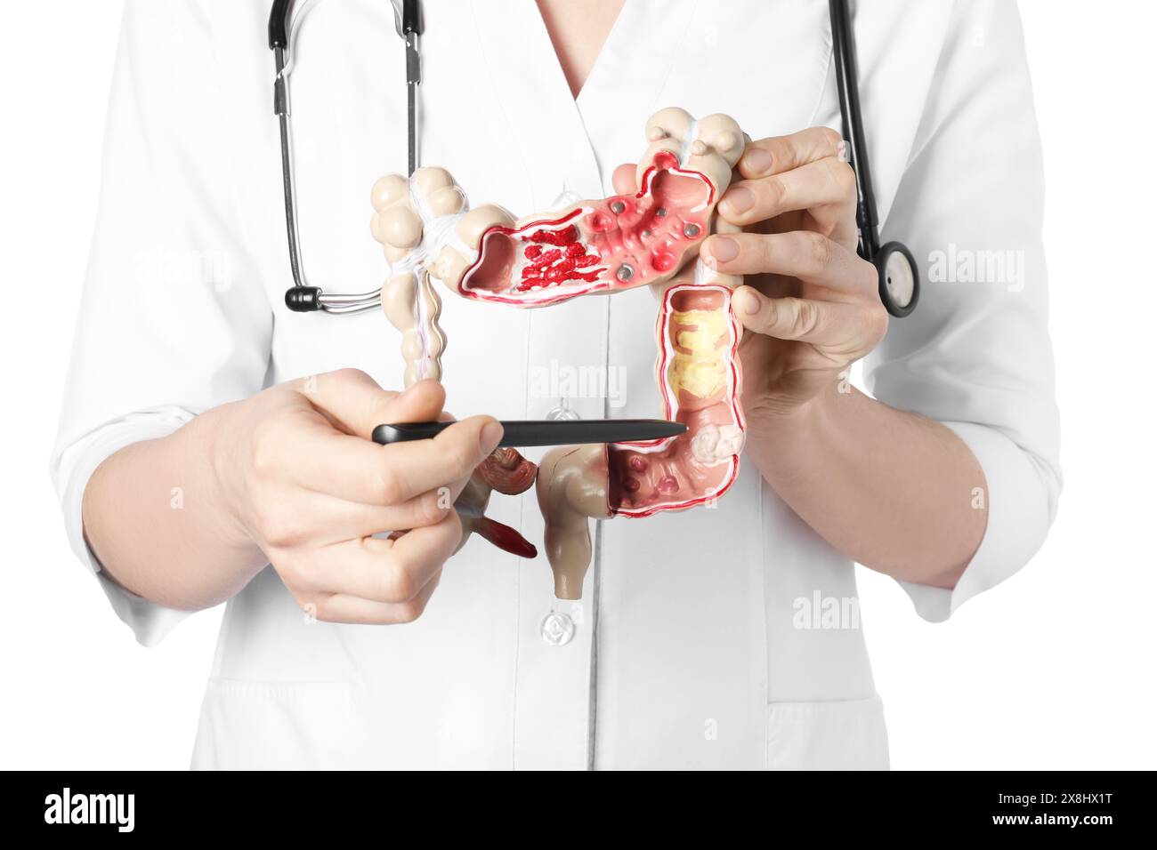 Doctor showing model of large intestine on white background, closeup ...