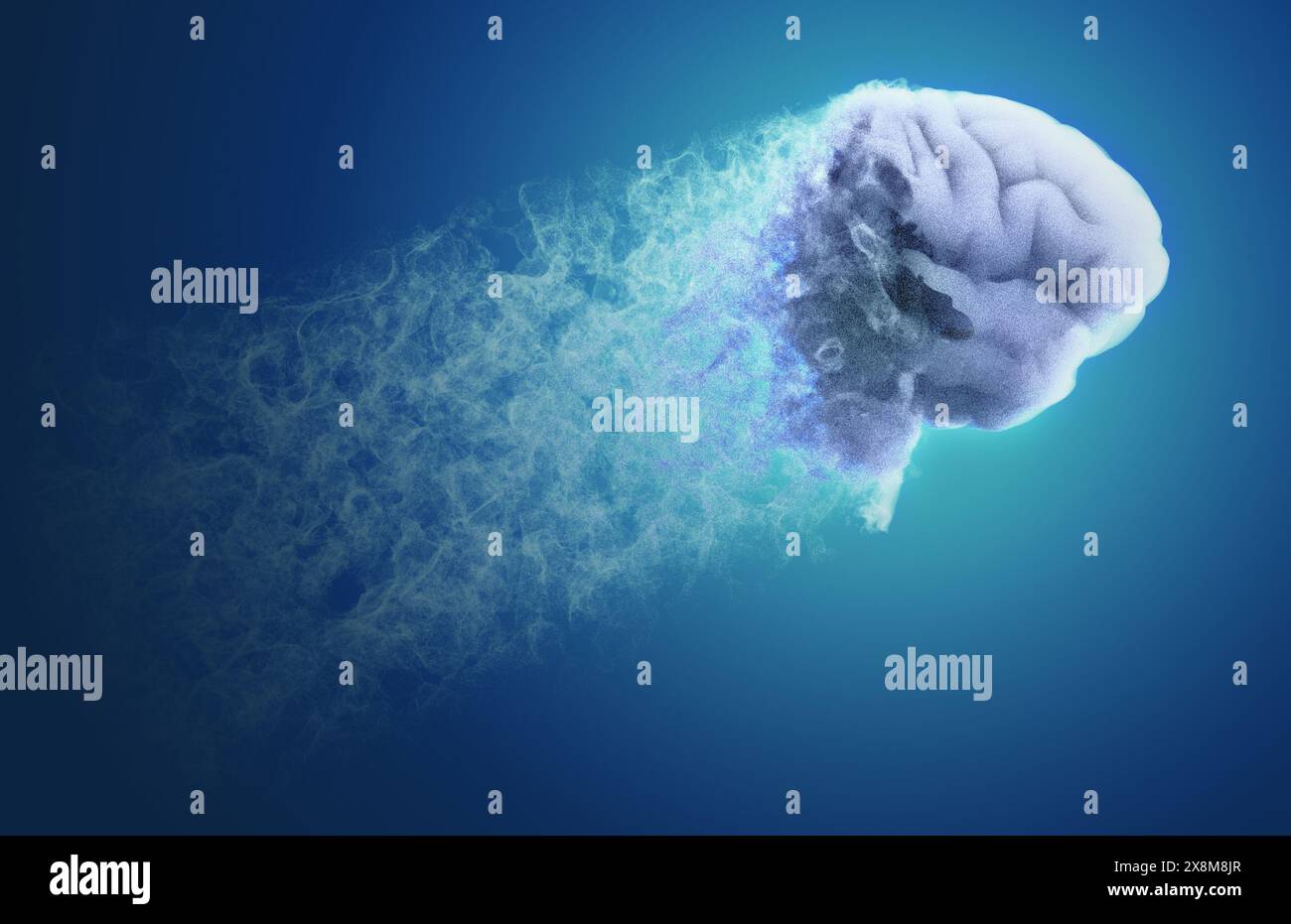 Brain seen from the side. Degenerative disease. Brain degenerative ...