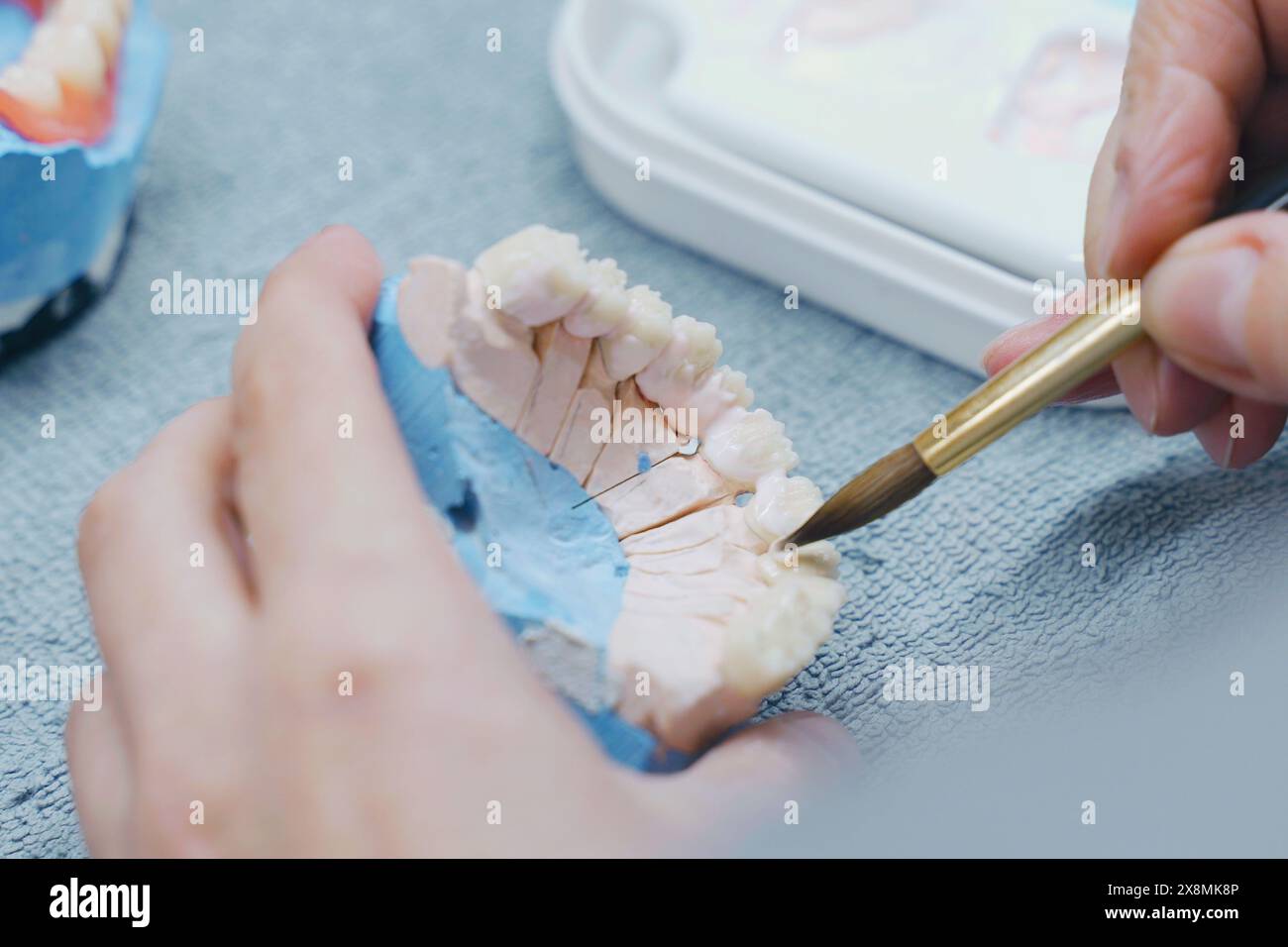 Implantats hi-res stock photography and images - Alamy