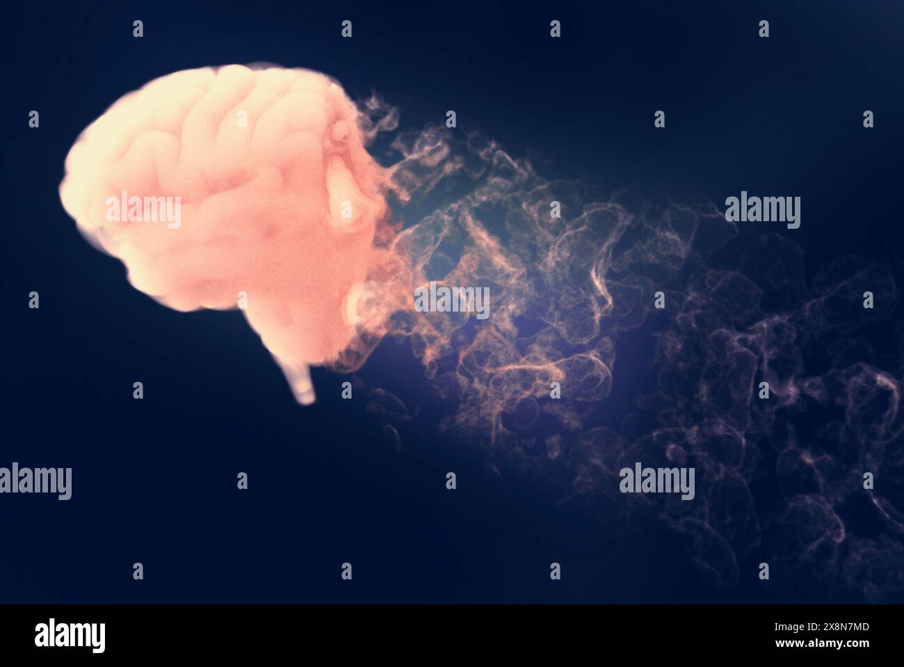 Brain seen from the side. Degenerative disease. Brain degenerative ...