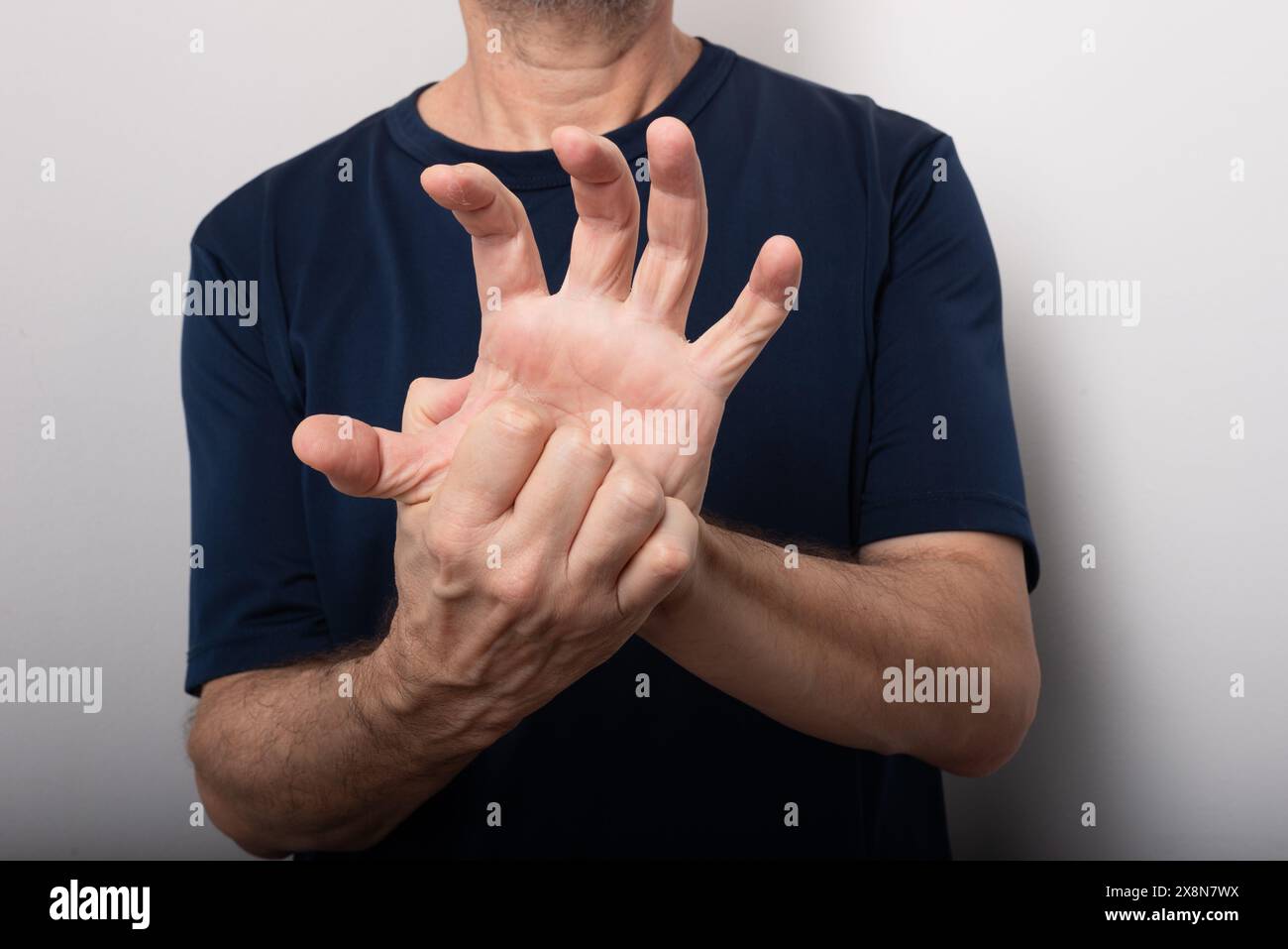 Middle aged man scratching his hand. Skin disease. Allergic reaction ...