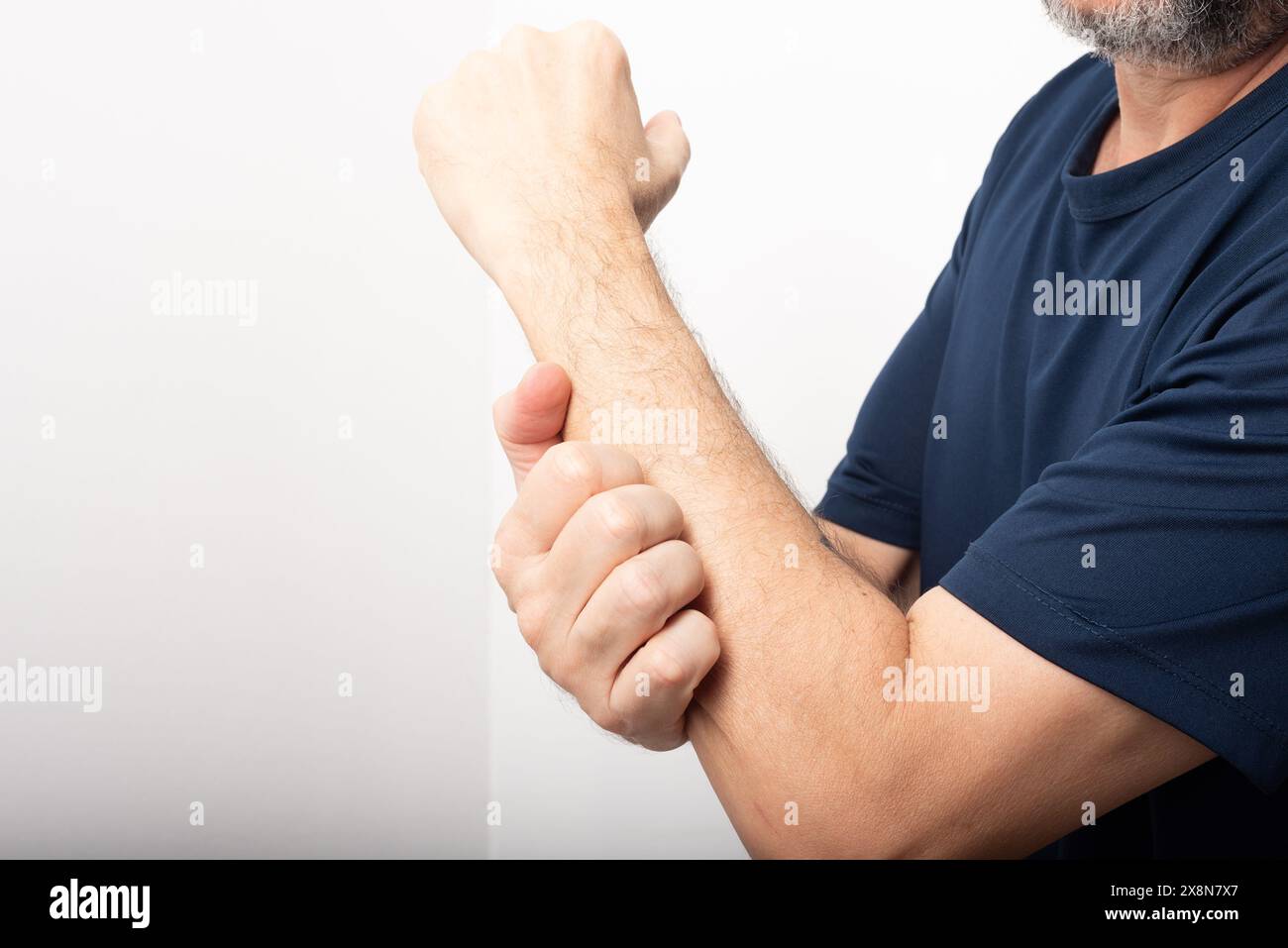 Middle-aged man scratching his forearm. Skin disease. Dermatological ...
