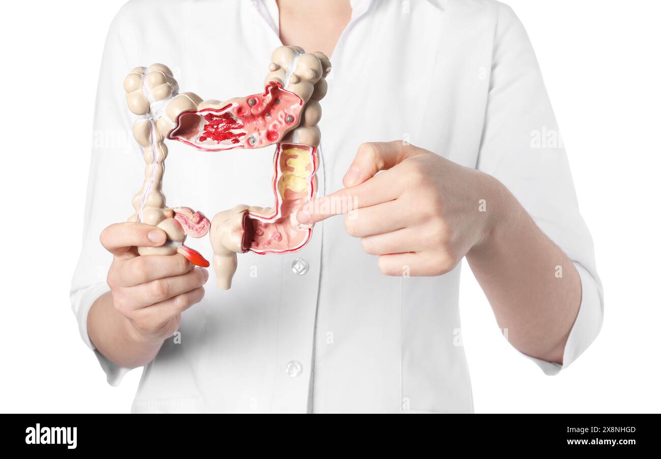 Doctor showing model of large intestine on white background, closeup ...