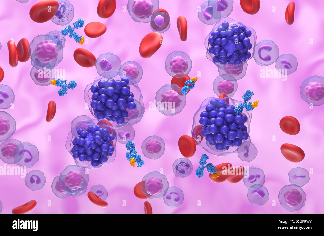 Diffuse large B-cell lymphoma (DLBCL) - isometric view 3d illustration ...