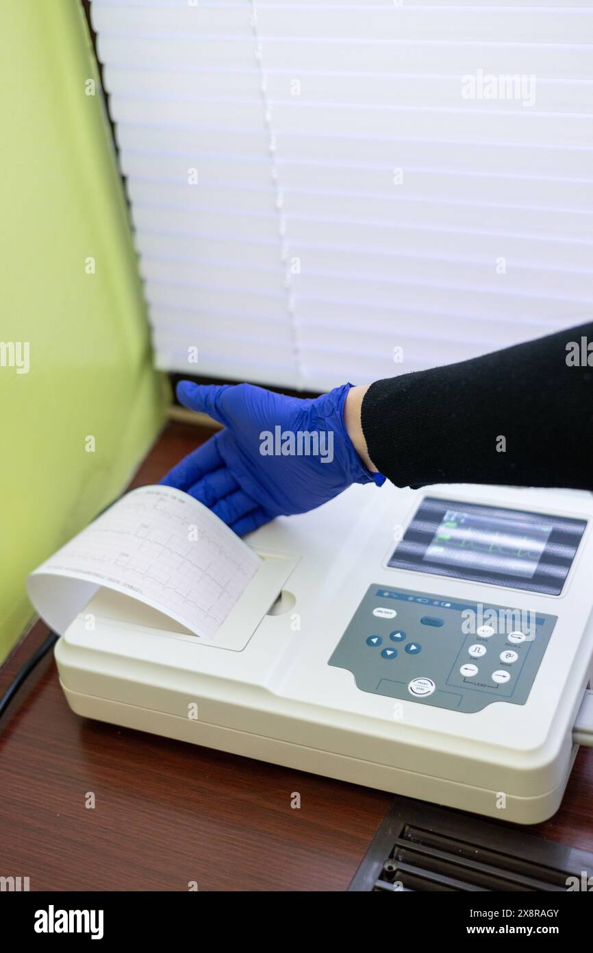 Heart ECG device. Electrocardiography of the heart in the hospital. A ...