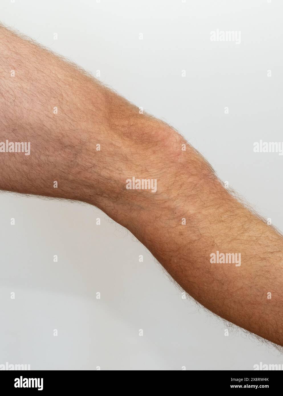 Outer side of male knee, anatomy and structure of the human body ...