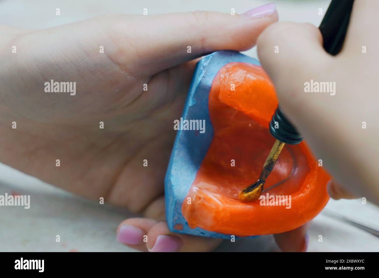 The dental technician makes a wax base and adds wax to form the mold ...