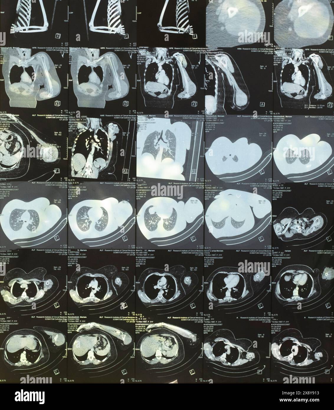 Magnetic computer tomography photo of women Stock Photo - Alamy