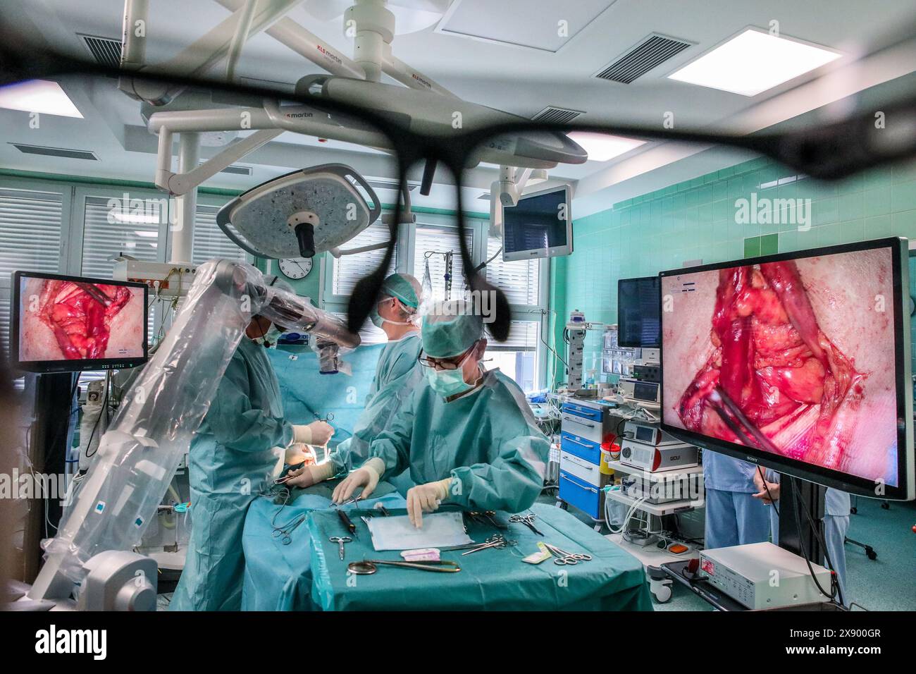 A test of satellite transmission of hernia surgery repair with using an ...