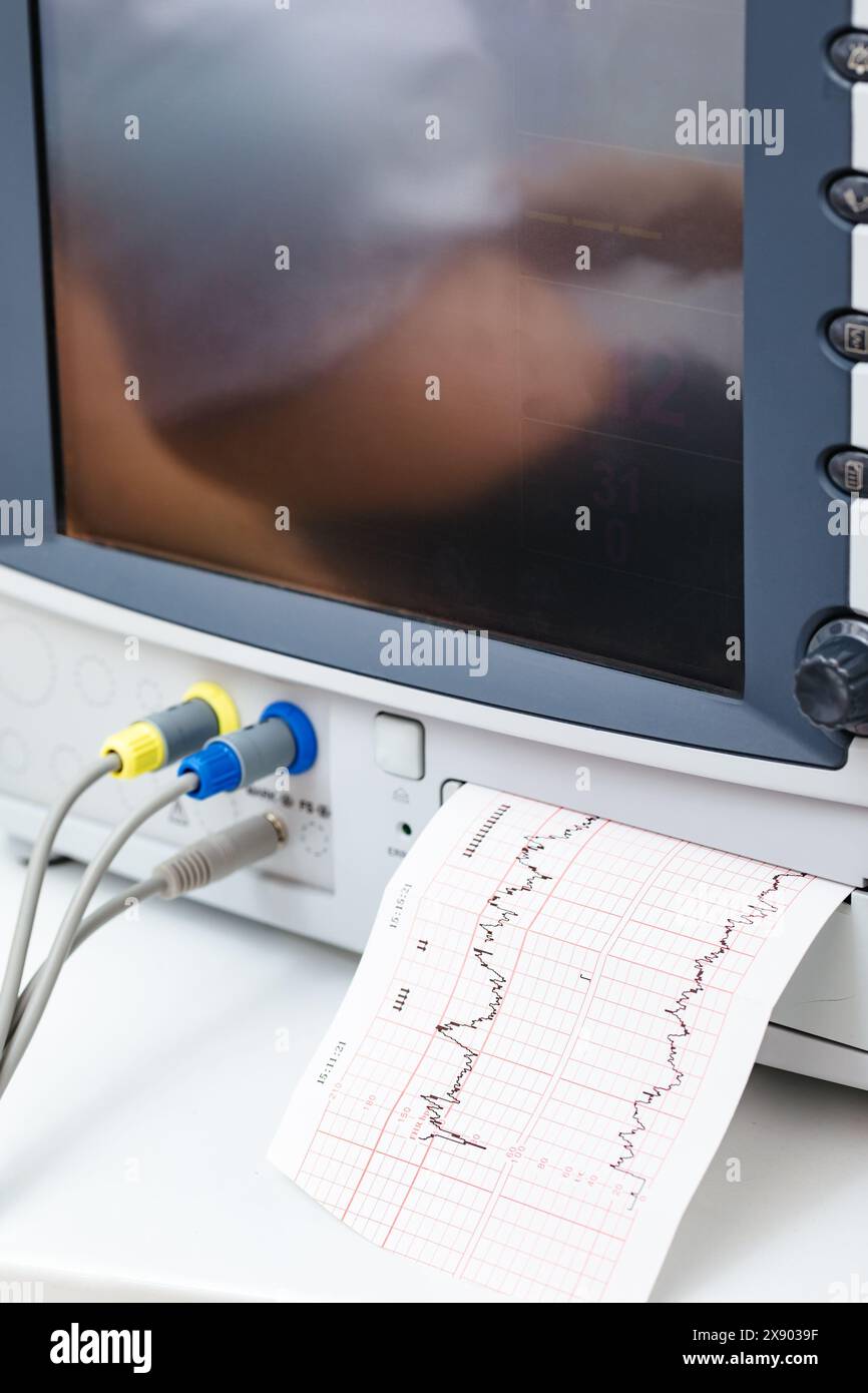 Baby heart rate monitor and printout hi-res stock photography and ...