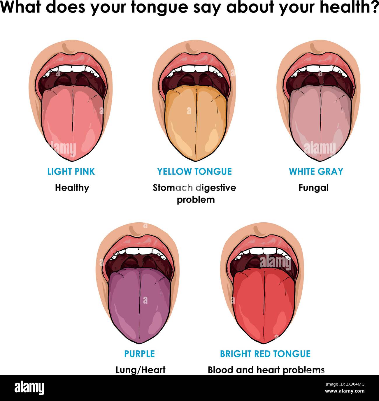 Tongue’s health sign vector illustration set Stock Vector Image & Art ...