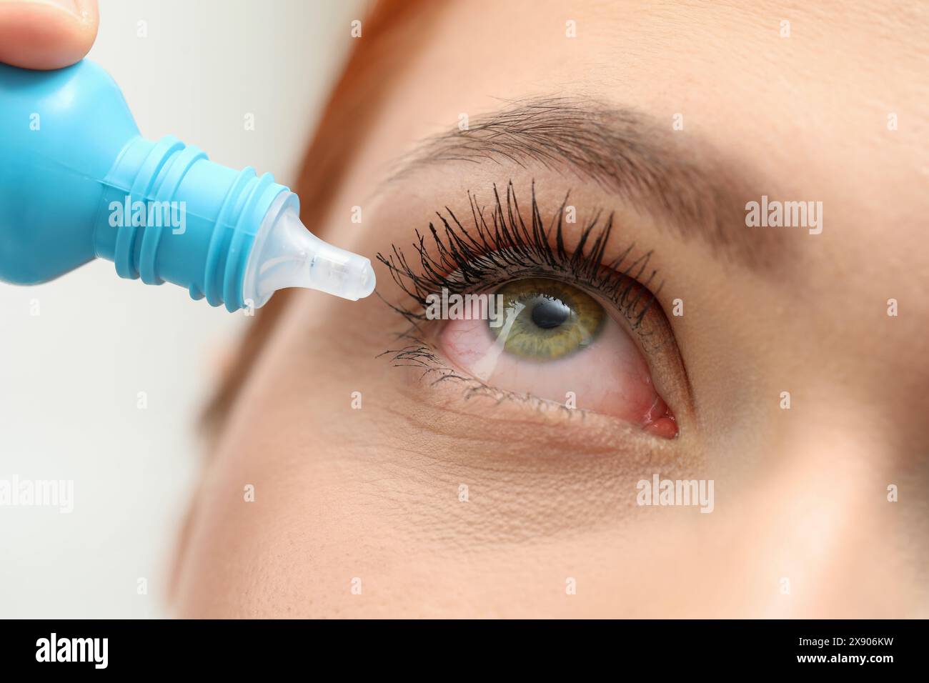 Woman with conjunctivitis using eye drops, closeup Stock Photo - Alamy