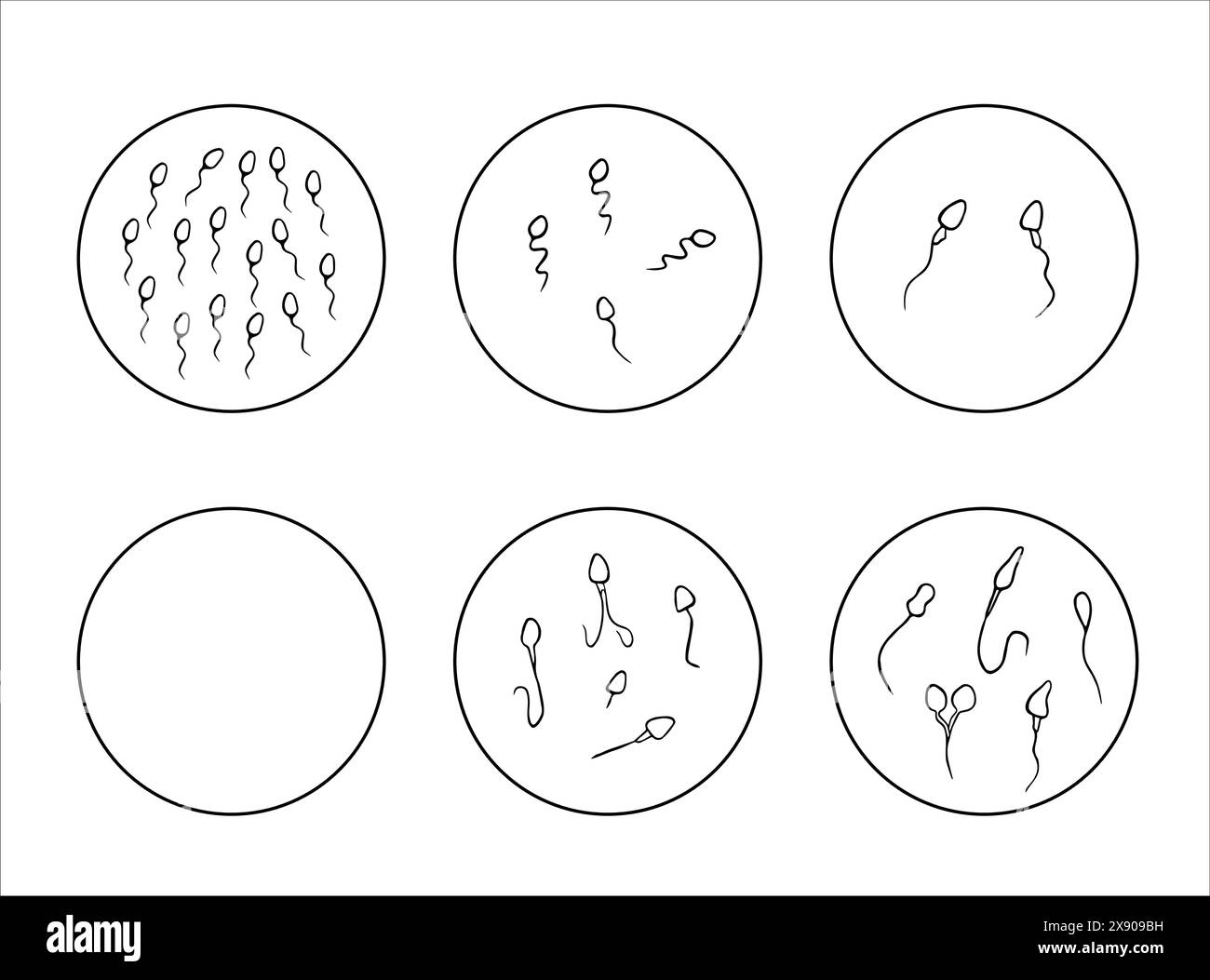Vector isolated illustration of sperm pathologies. Spermogram. Sperm ...