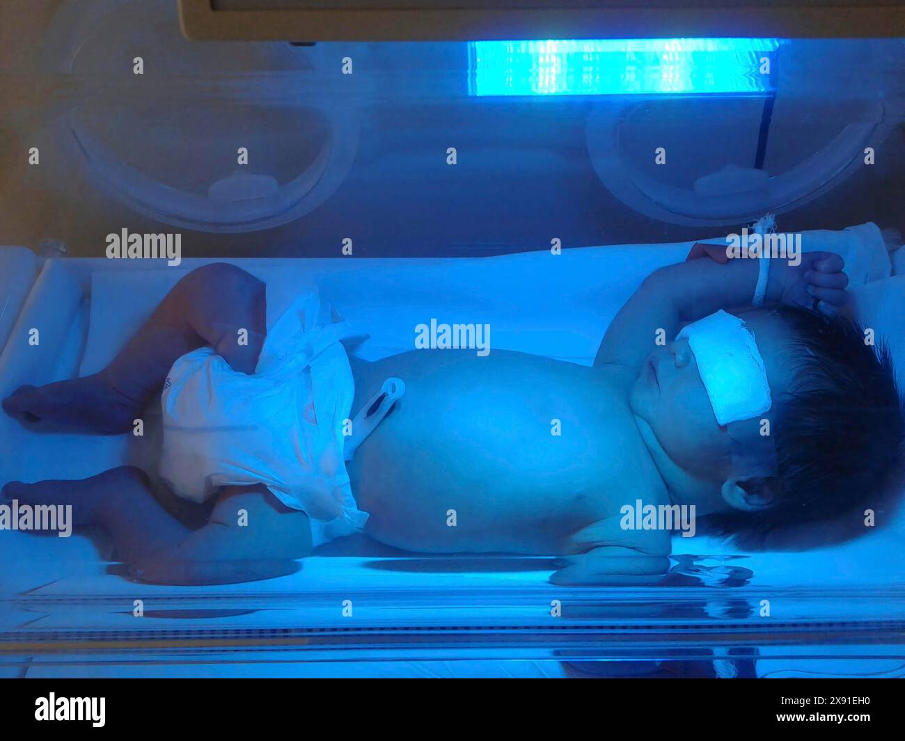Newborn baby sleeping in an incubator under blue light for neonatal ...