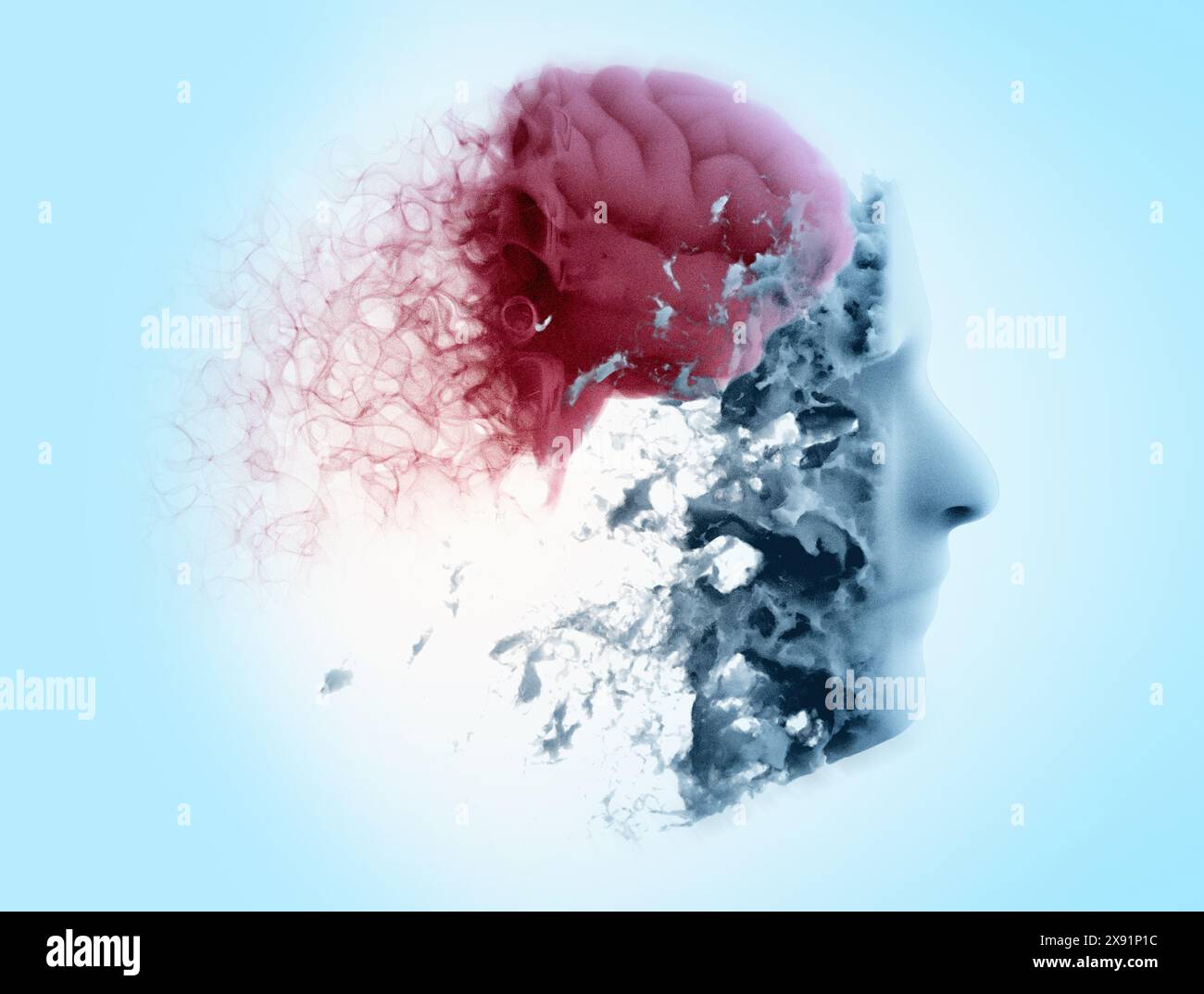 Face seen from the side. Degenerative disease. Brain degenerative ...