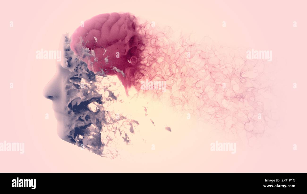 Face seen from the side. Degenerative disease. Brain degenerative ...