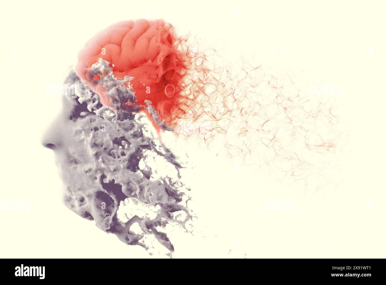 Face seen from the side. Degenerative disease. Brain degenerative ...