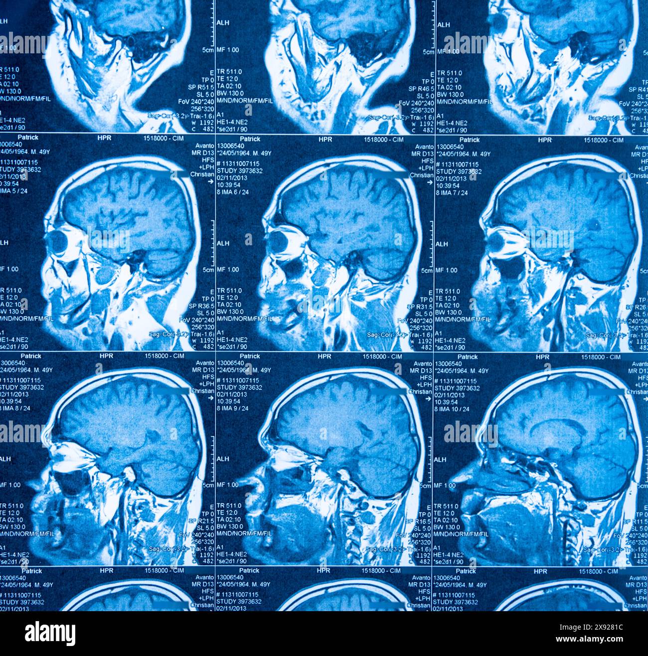 Tomography of the brain obtained by scanner. Brain scan 013843 033 ...