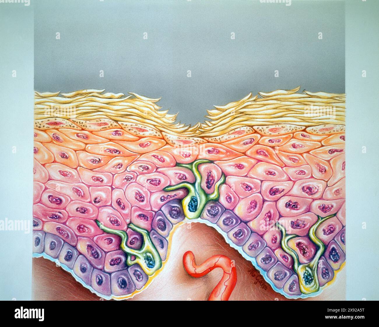 Cells : the horny layer yellow, granular layer orange, malpighian layer ...