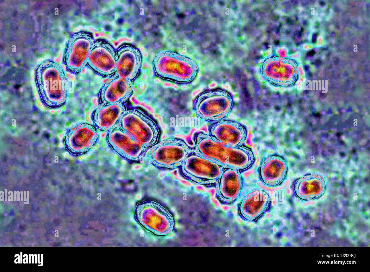Pneumococcus Streptococcus pneumoniae, pneumococcus is a bacteria ...