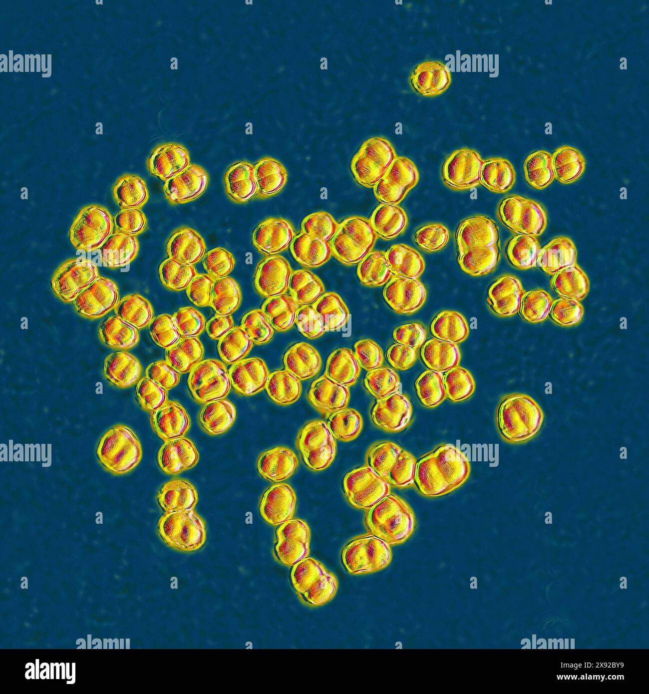 Meningococcus or meningococcal disease or Neisseria meningitidis, is a ...