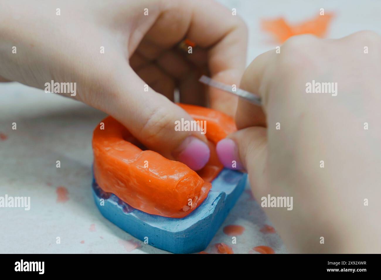 The dental technician makes a wax base and adds wax to form the mold ...
