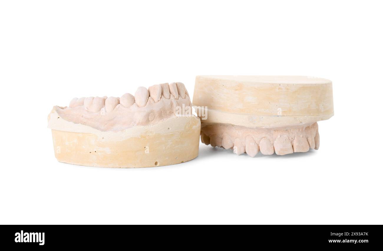Dental model with jaws isolated on white. Cast of teeth Stock Photo - Alamy