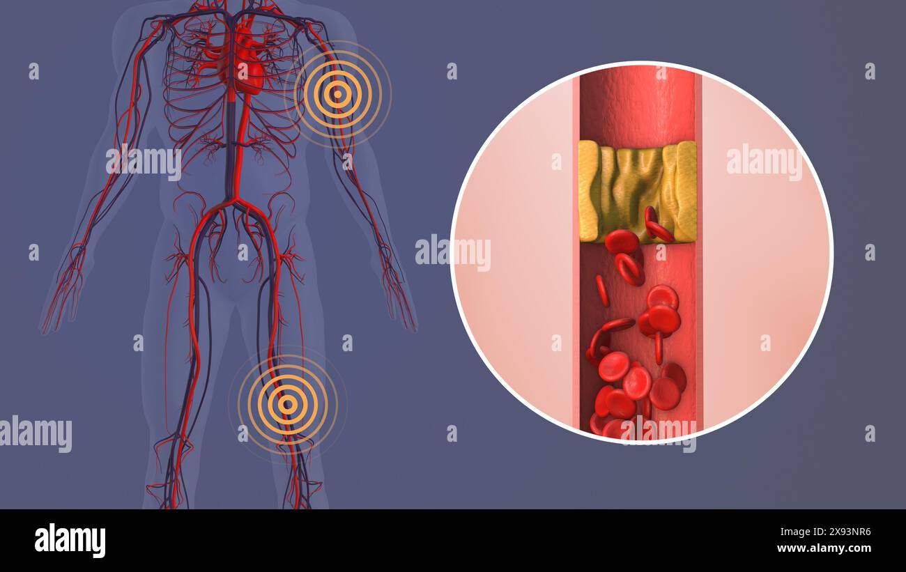Peripheral nerve anatomy hi-res stock photography and images - Alamy