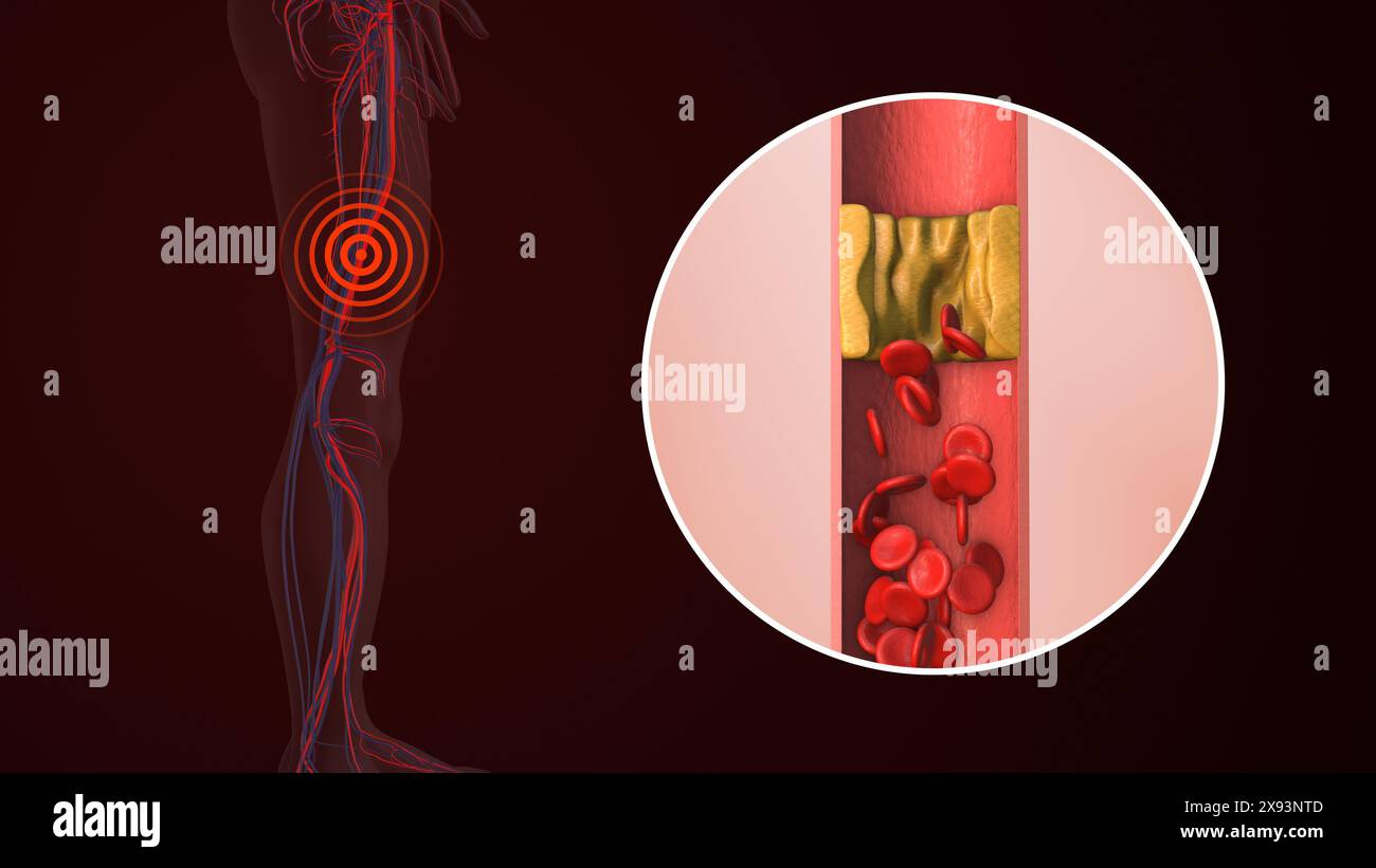 Peripheral nervous system hi-res stock photography and images - Alamy