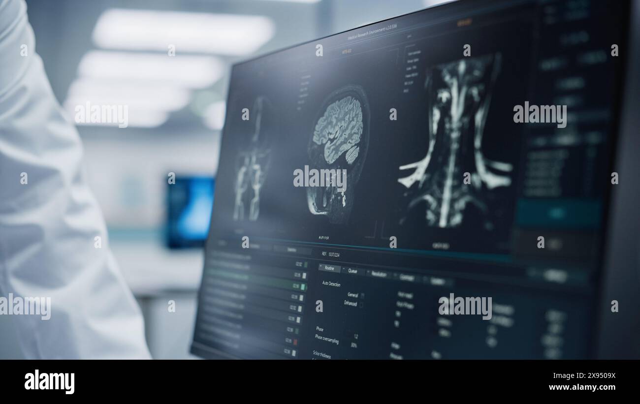 Medical Hospital: Neurologist and Neurosurgeon Talk, Use Computer ...