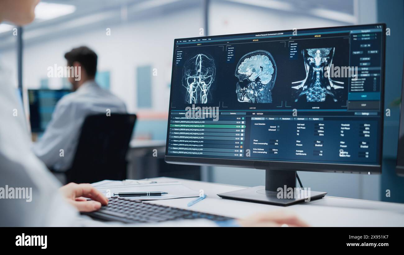 Ct scan brain damage hi-res stock photography and images - Alamy