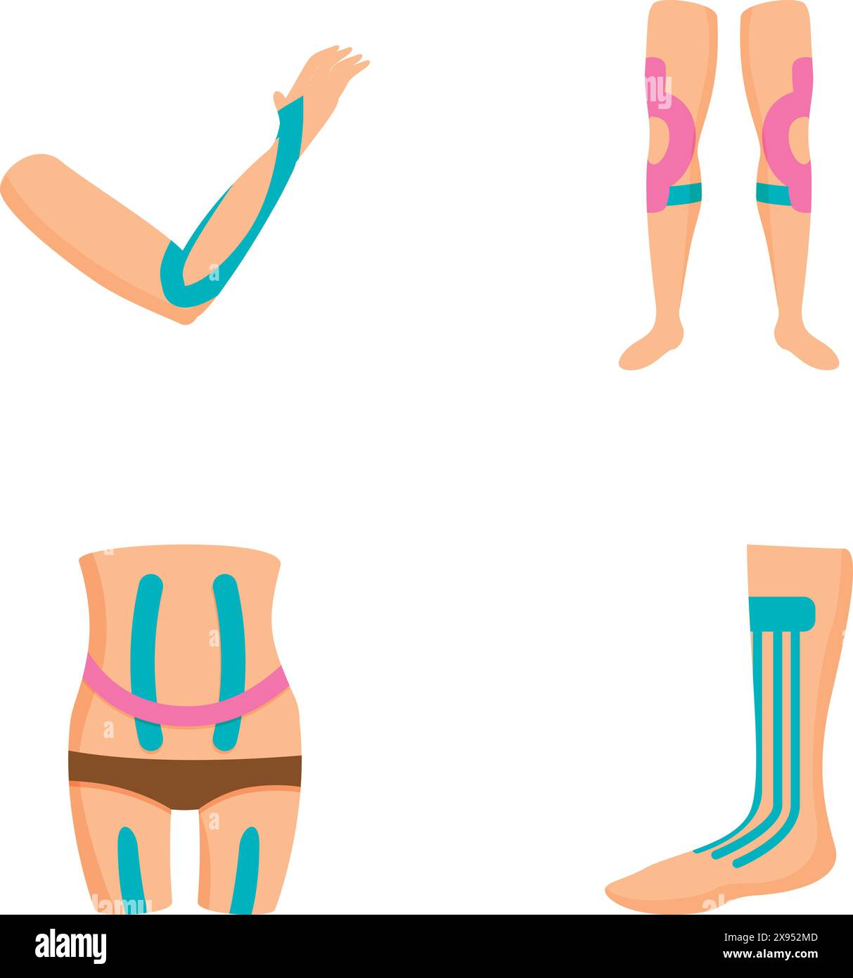 Set of vector illustrations depicting elbow, knee braces, back support ...