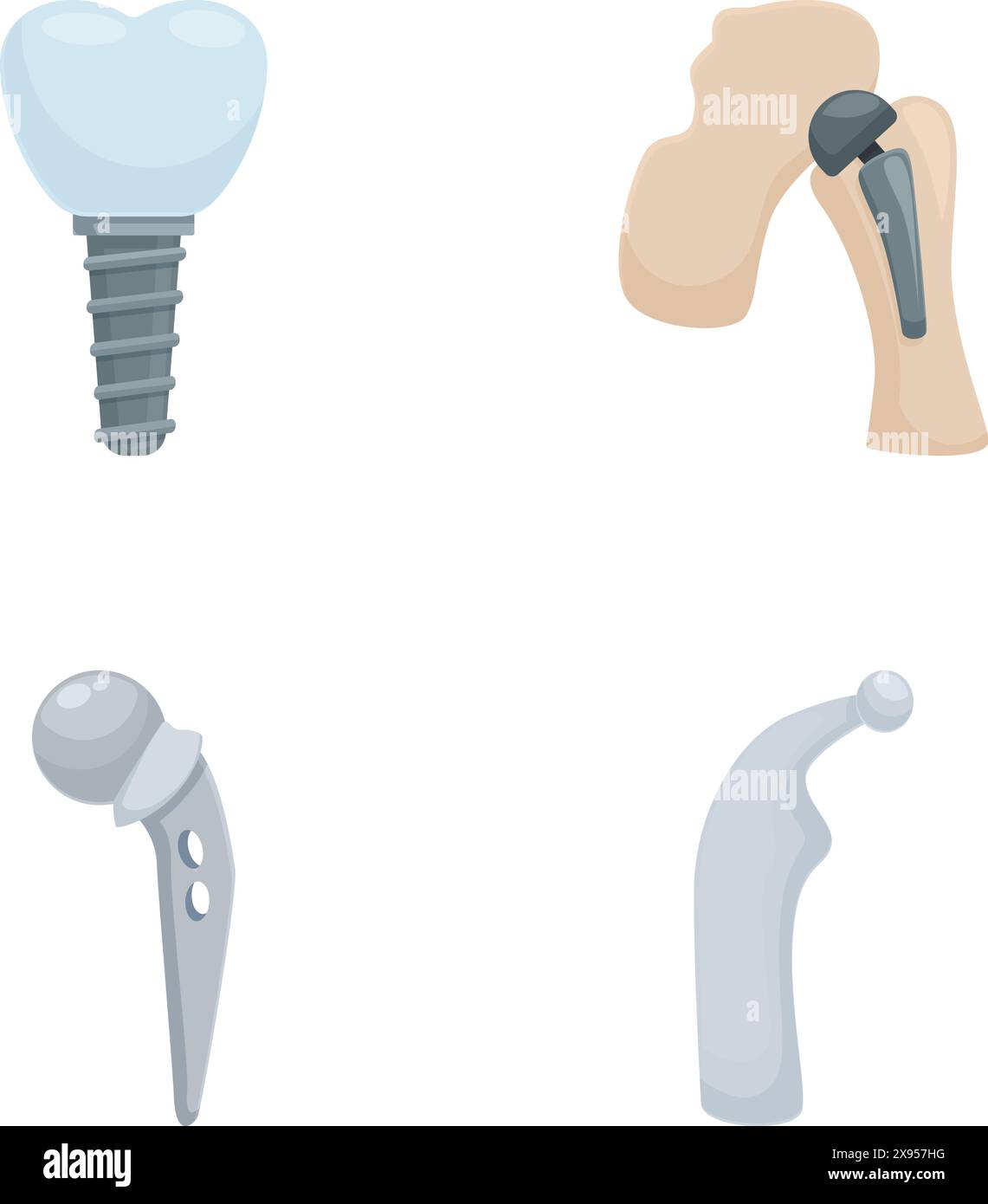 Vector illustration of different medical implants for dentistry and ...