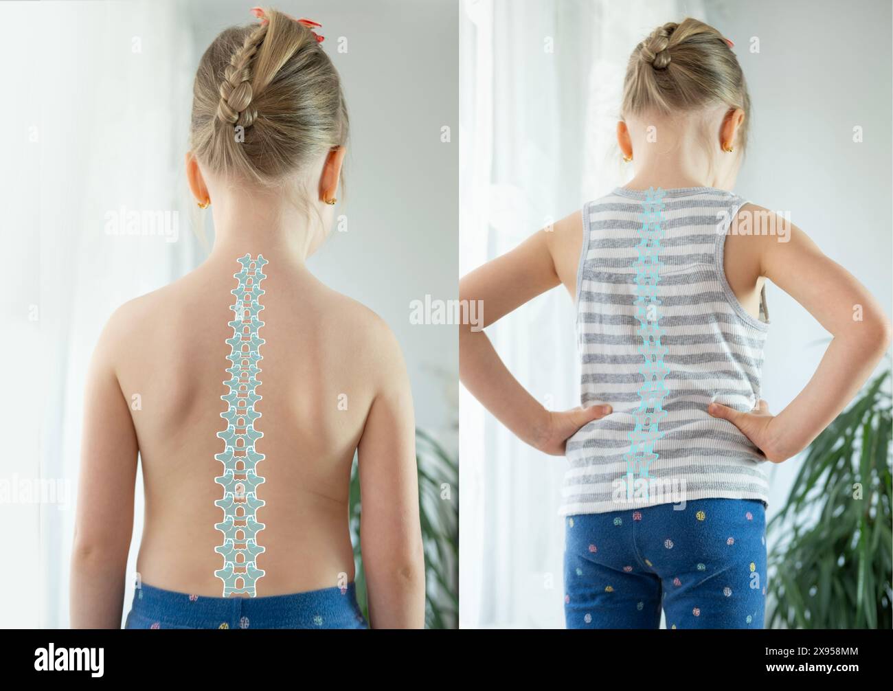 Different views healthy child's back in multiple postures, five-year ...